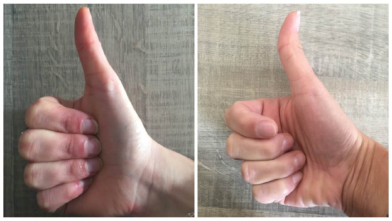 Personality: Know what your thumb looks like when you thumbs up Kannada ...